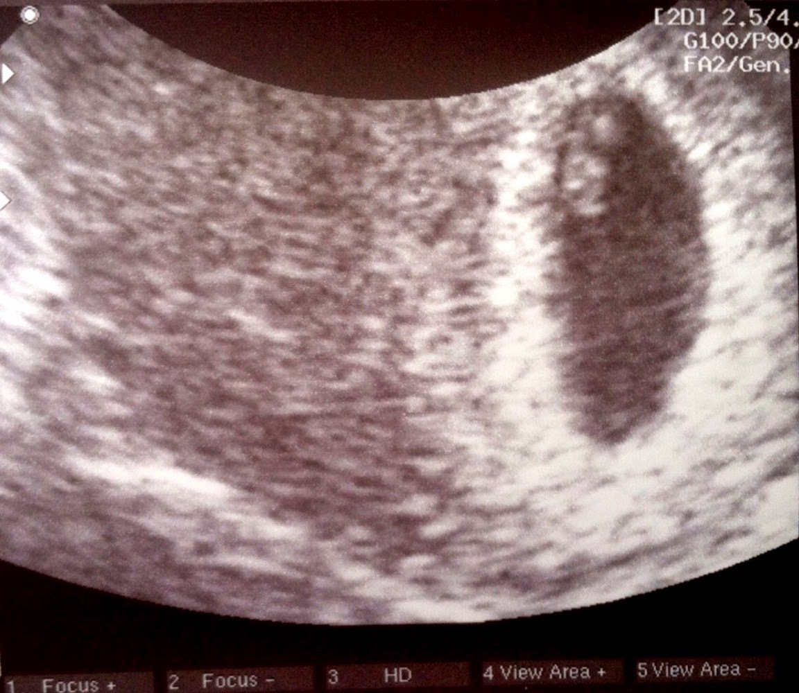 From Fertile Myrtle to Infertile Myrtle: May 2014