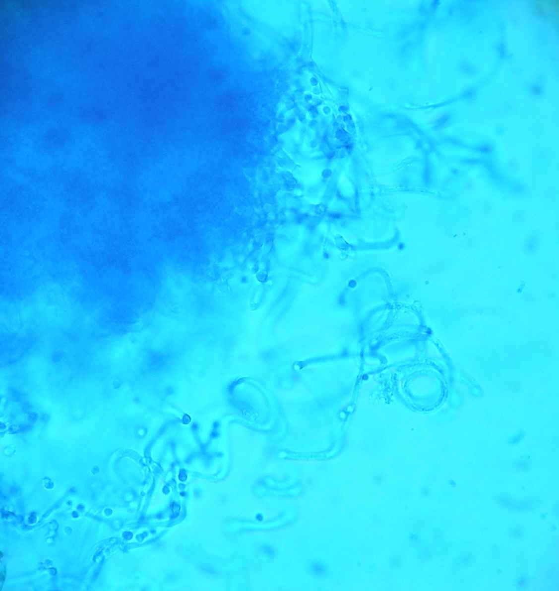 ATLAS MICOLOGIA: TRICHOPHYTON MENTAGROPHYTES