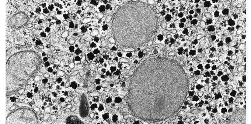 Síntesis y regulación del glucógeno - Biología