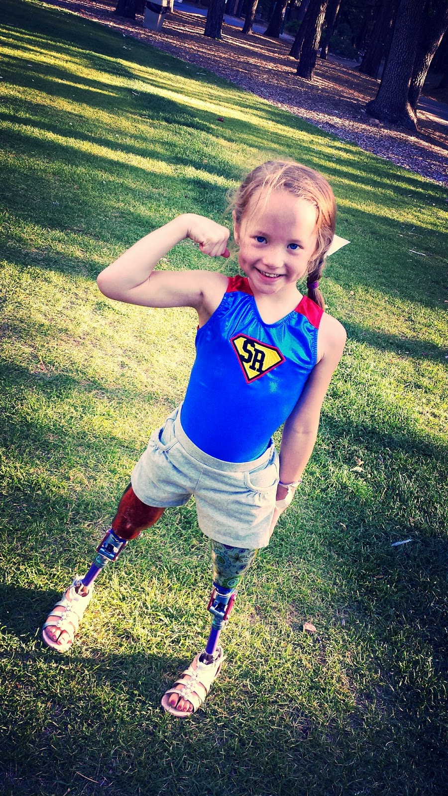 Amputee Beautiful Girls Im Happy Despite Disability Amputee Girls