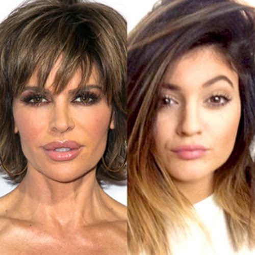 Lisa Rinna Thinks Kylie Jenner Had Lip Augmentation