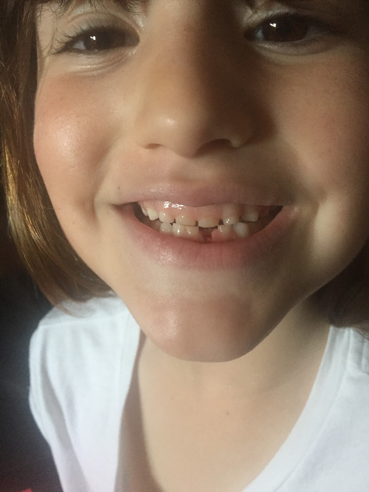 Mi primera vez - El primer diente caído | Mi vida en un suspiro