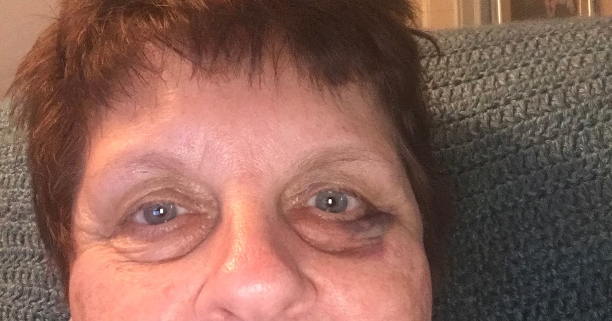 Time for Mimi: Bad eye makeup?