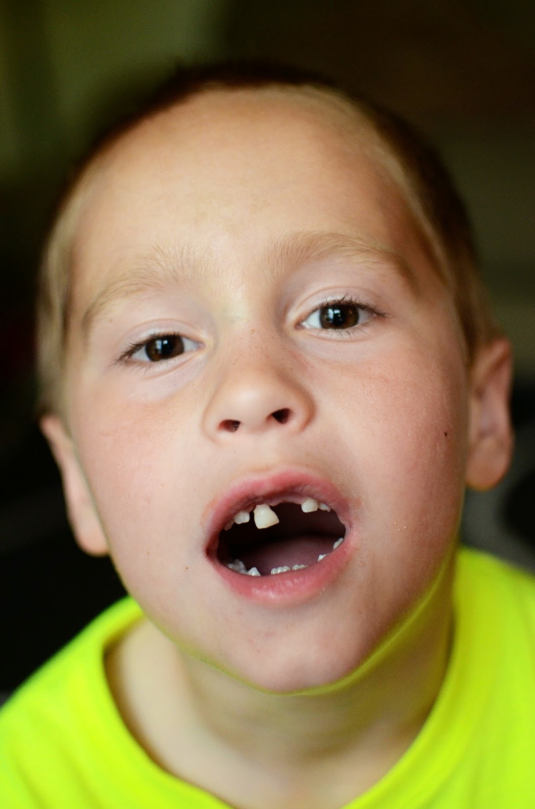 Adventures in Japan!: snaggletooth.