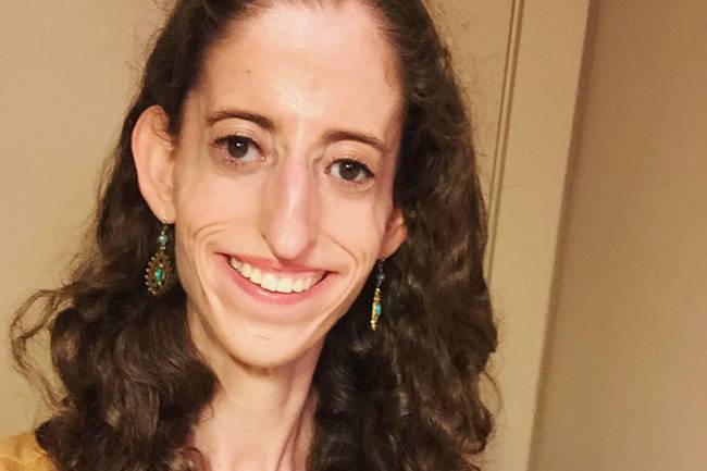 SAÚDE CANAL DA VIDA: Mulher que quase nunca tem fome pode ajudar na cura da obesidade