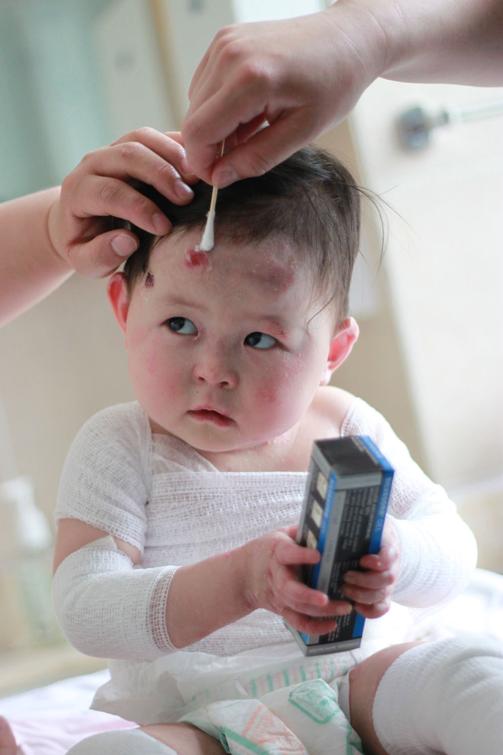 What Is Eb In Babies at Callie Ellis blog