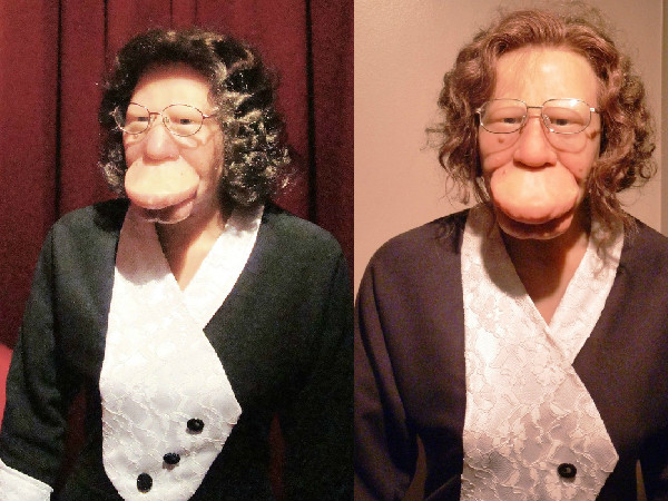 8 Perempuan Inspiratif dengan Kondisi Tubuh Paling Langka di Dunia ...