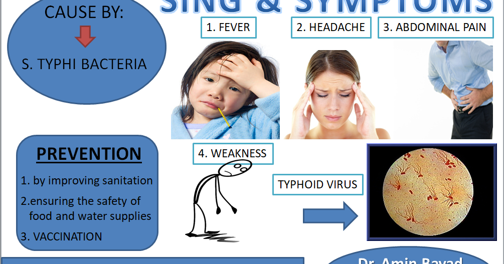 Typhoid Fever: Symptoms, treatment, causes, and prevention ~ Ceiria