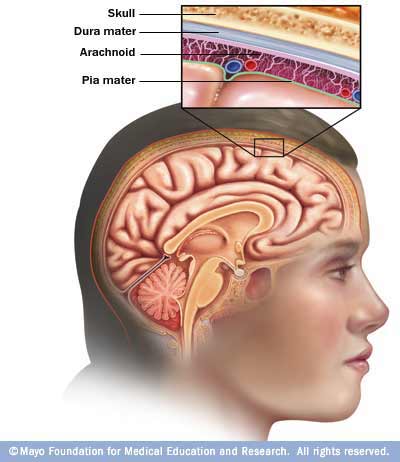PENYAKIT INFEKSI OTAK