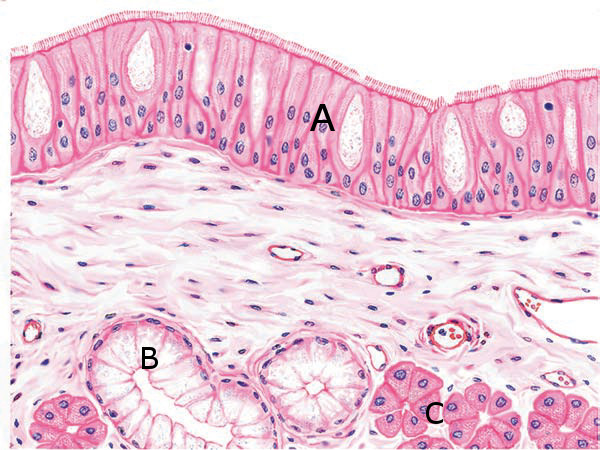 Histología en Imágenes : TIPOS DE EPITELIOS