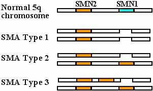 RNAi Therapeutics: Oligonucleotide Therapeutics for Spinal Muscular ...