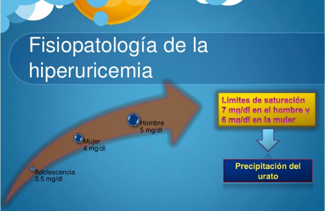 ACIDO URICO Gota: ¿Qué es la hiperuricemia? - (ácido úrico elevado)