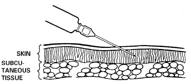 AMG: FIȘE- TEHNICI DE NURSING -4Injecția intradermică