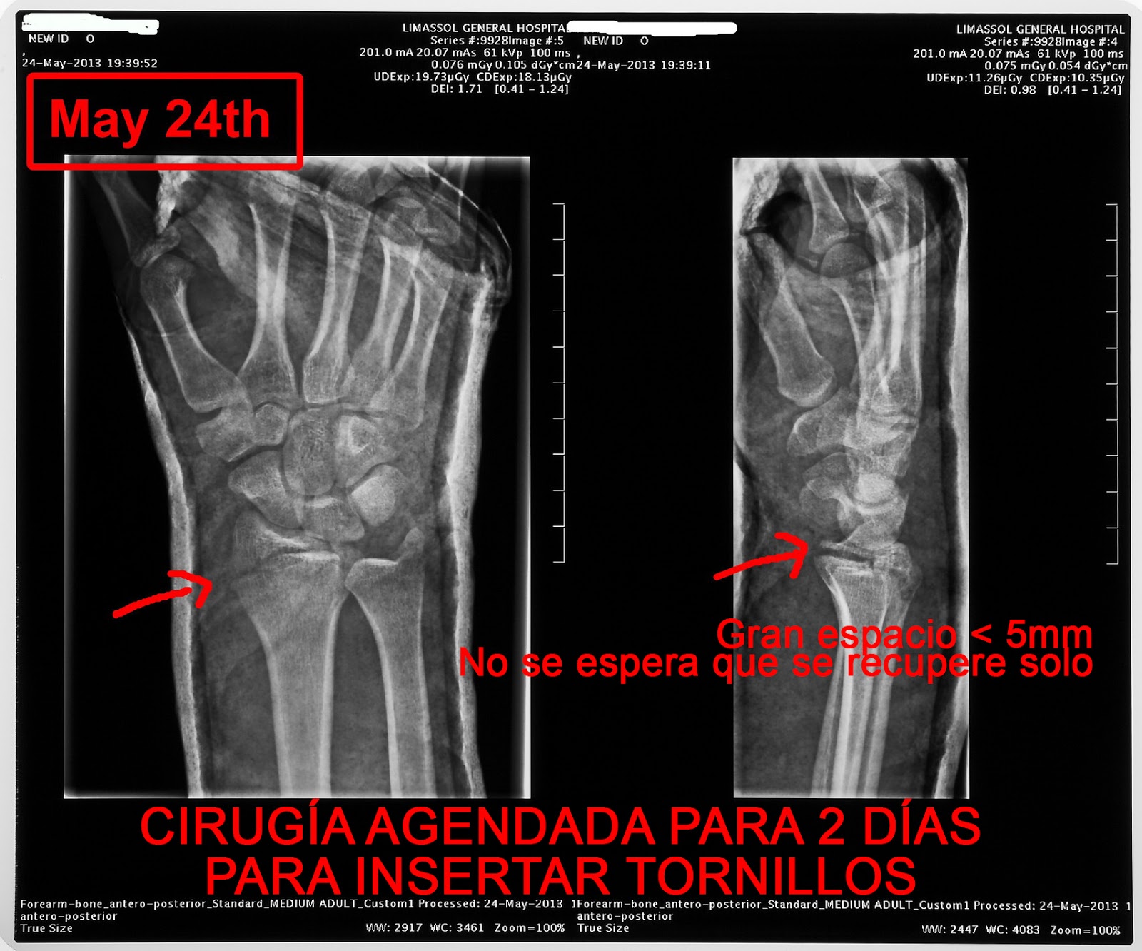 ABR HISPANO - Rehabilitación Biomecánica Avanzada: ABR Combina Milagros ...
