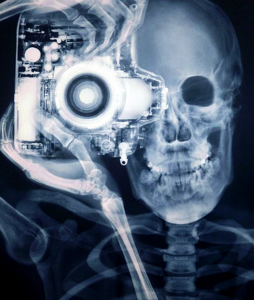 Medical Imaging: X-ray Discovery