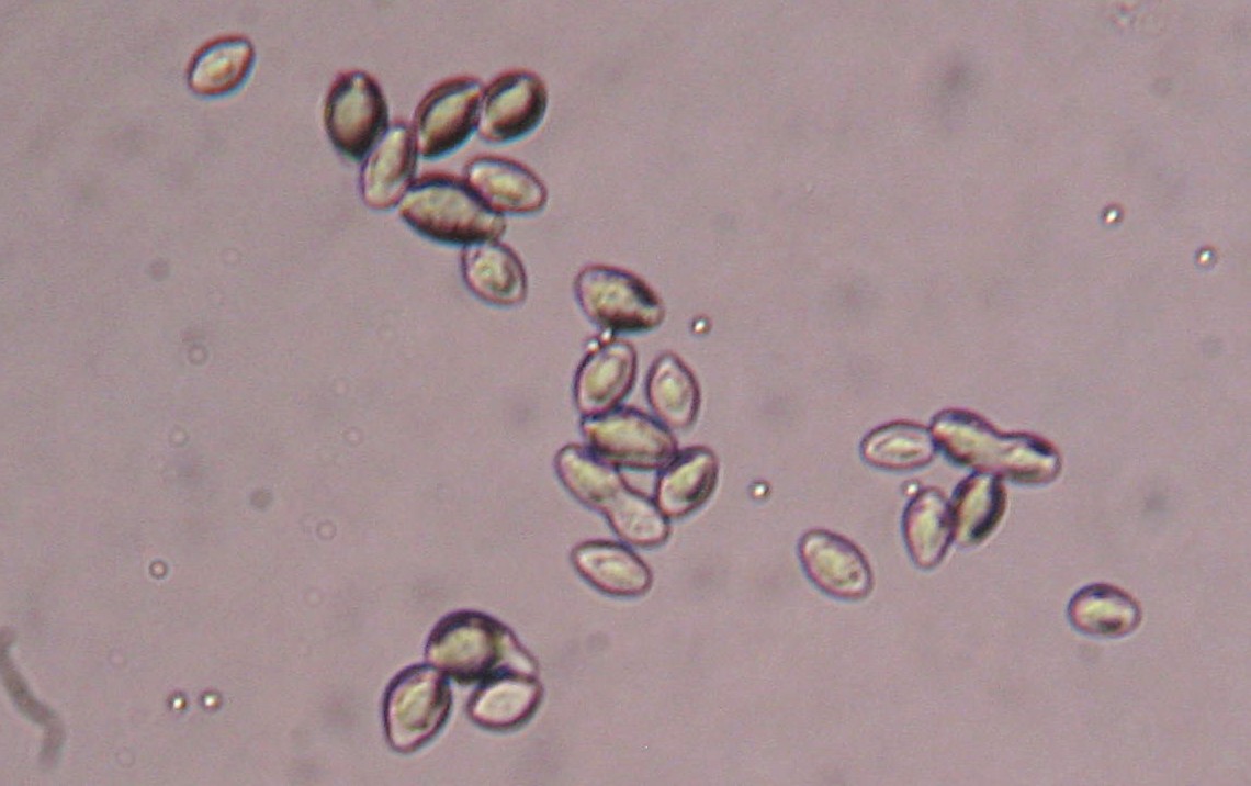 TAMU_PLPA631_FungalBlog_LornaNissen: Lab 6