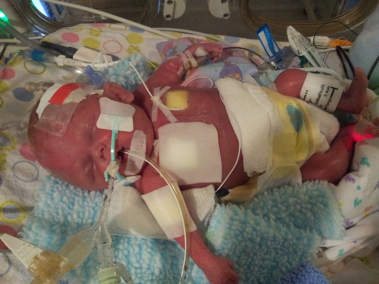 A Three E Circus: Baby Eagan - NICU Day 40 - Forty Days and Forty Nights