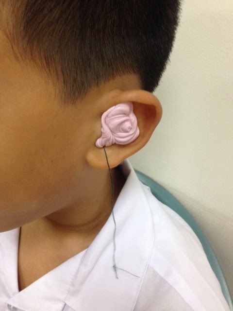 The Phenomenal Mama: What To Do With Swimmer's Ear