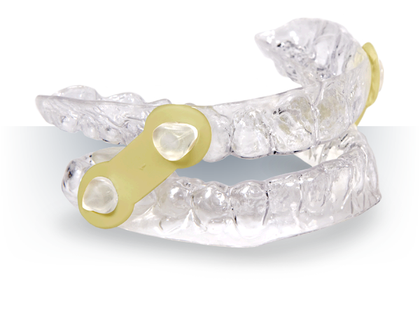 Everything About Sleep: Mandibular Advancement Device Walgreens