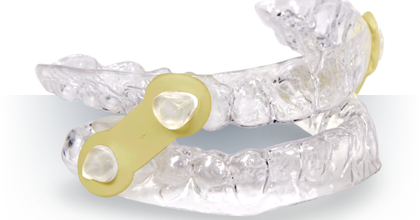 Everything About Sleep: Mandibular Advancement Device Walgreens