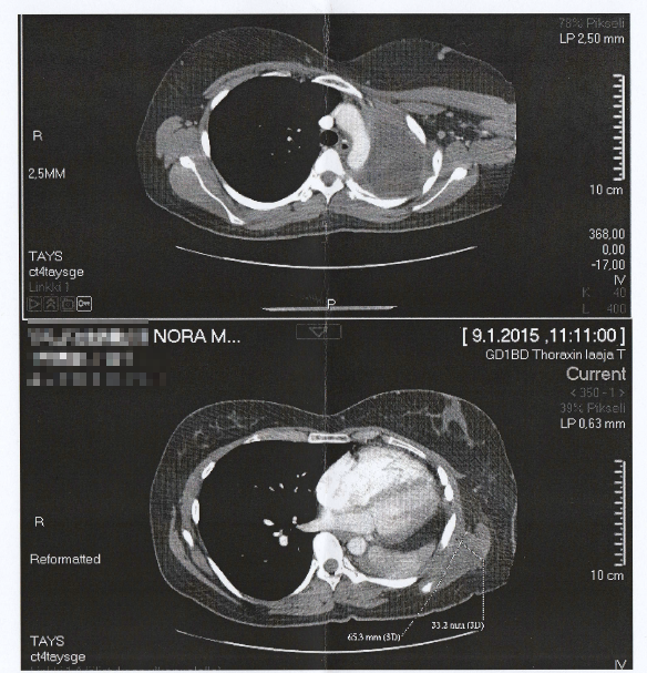 The Little Things: Keuhkosta ihmeteltävää