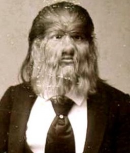 Kaitlin's Honor Biology Blog: Hypertrichosis Research
