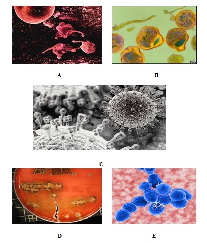 Pengertian, Gejala, Pencegahaan dan Pengobatan ISPA