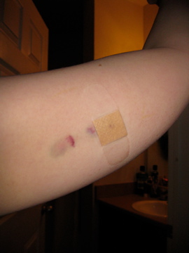 Love and Some Verses: New birth control method: Implanon