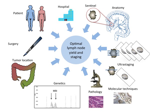 Surgical Science Blog: Lymph nodes in colon cancer