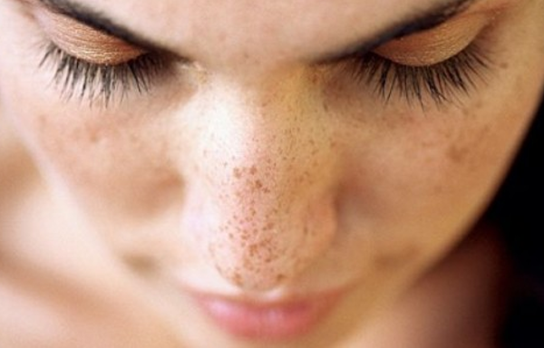 MANCHAS CUTÁNEAS: A CADA TIPO, SU SOLUCIÓN