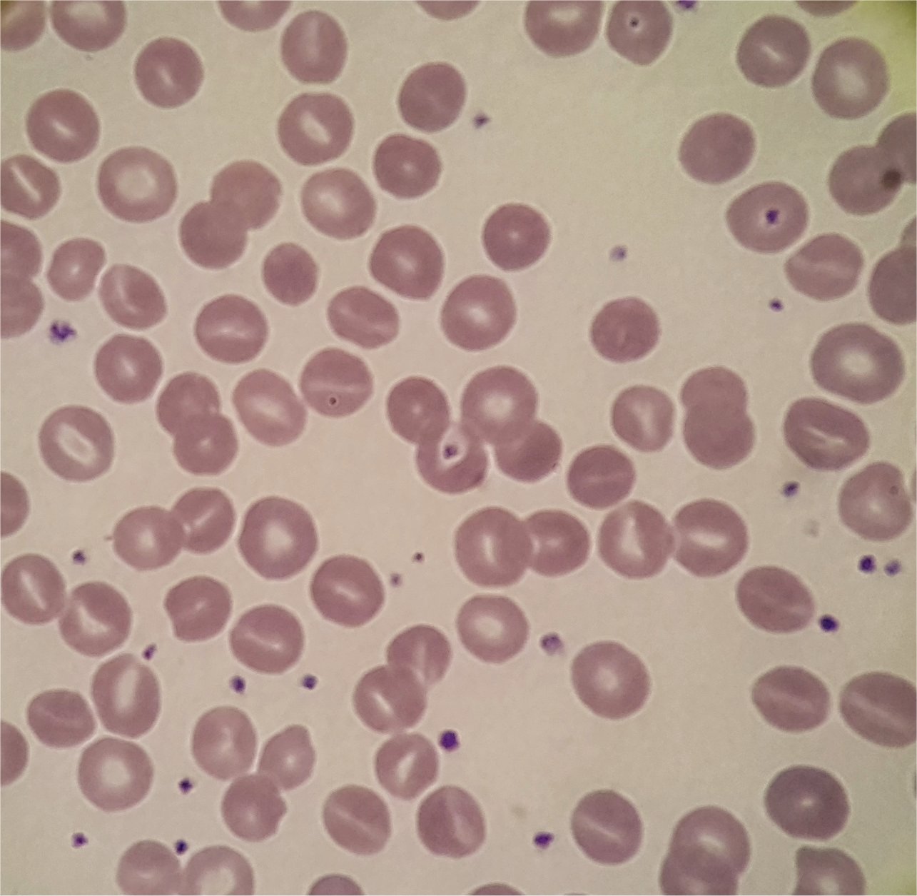 A Dull Day At Work...?: 24 January 2018 (Wednesday) - Stomatocytes