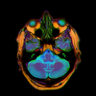 Nevit's blog: Color MRI of the Brain