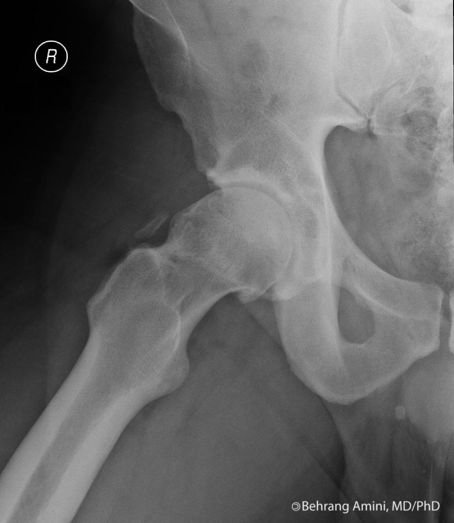 Roentgen Ray Reader: The Dunn View