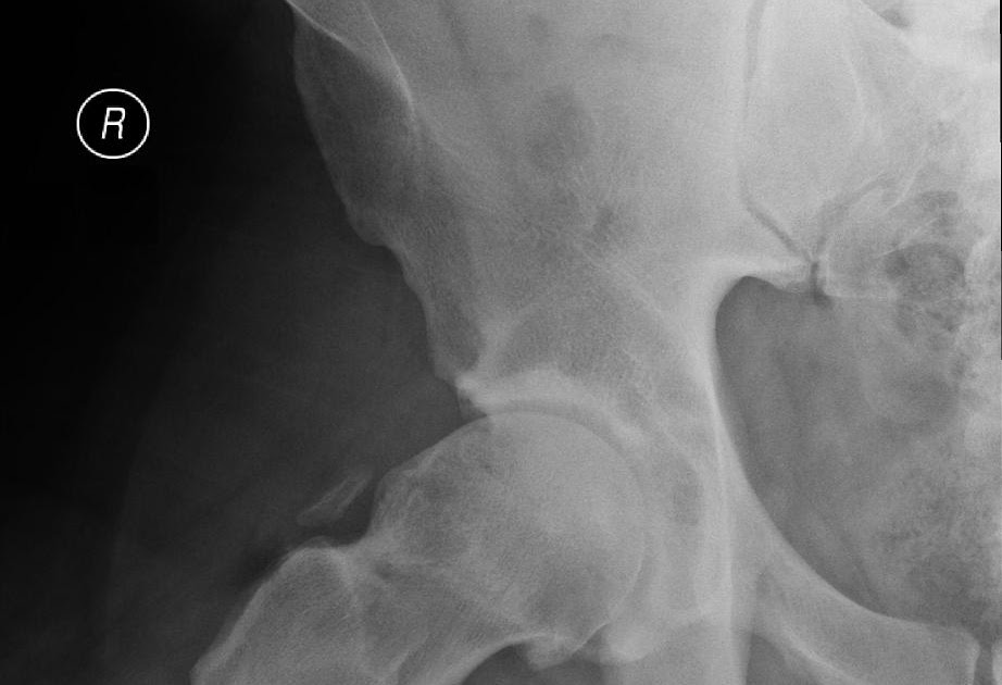 Roentgen Ray Reader: The Dunn View