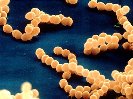STREPTOCOCCUS PNEUMONIAE "PNEUMOCOCCUS" | All Microbes