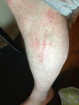 For Tomorrow, We...: Look Forward to Watch Your Behind