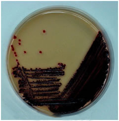 PHARMACEUTICAL MICROBIOLOGY: Streaking