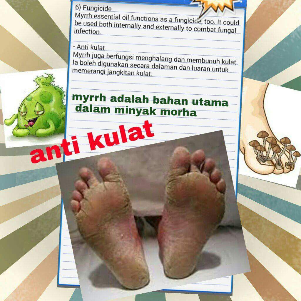 Dah ada Minyak Morha?: Khasiat unik myrrh