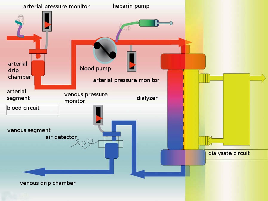 Team-the-best1: Hemodialysis Technique ...what is dialysis .....