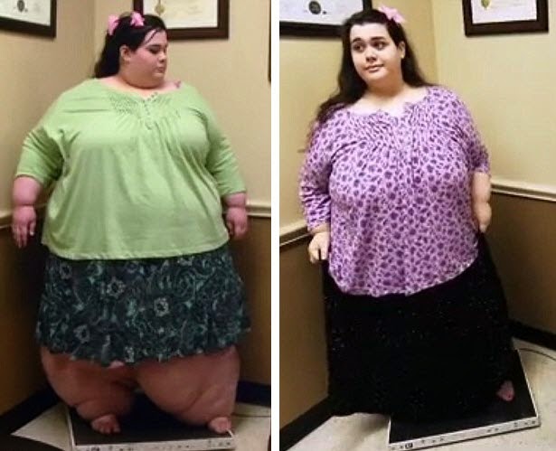 Morbidly Obese Amber Rachdi Loses Half Her Body Weight After Hitting