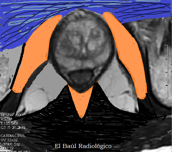El Baúl Radiológico: EL GRITO, (Edward MUNCH) EN TOMOGRAFÍA POR ...