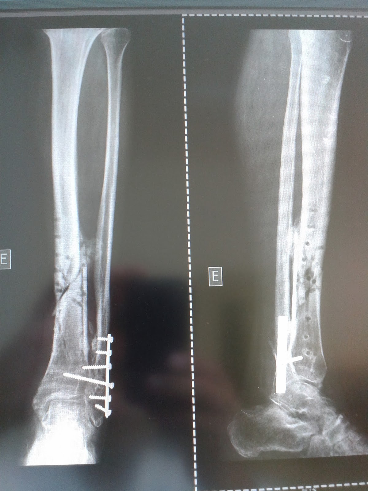 Dicas De Radiologia Tudo Sobre Radiologia Veja Quais SÃo Os