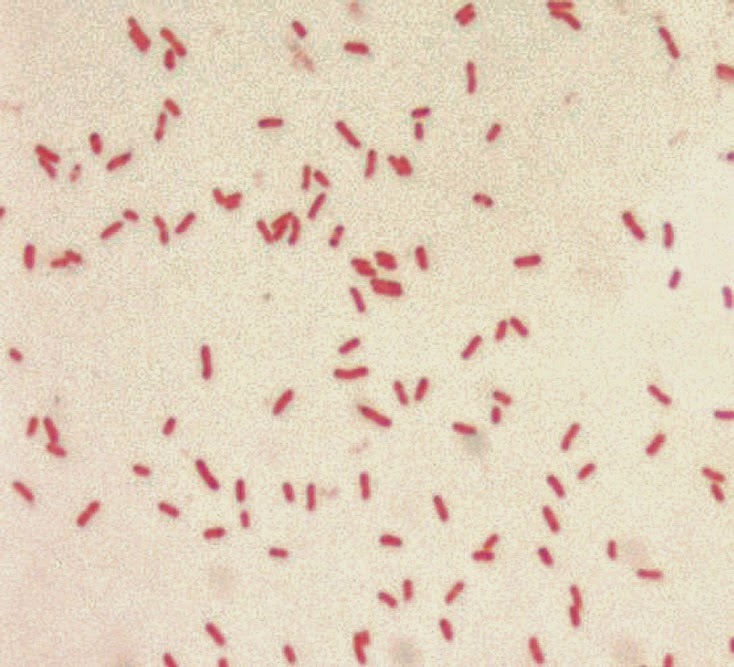 Gram-Negative Bacilli | Tuyenlab