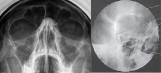 Estudo Radiográfico