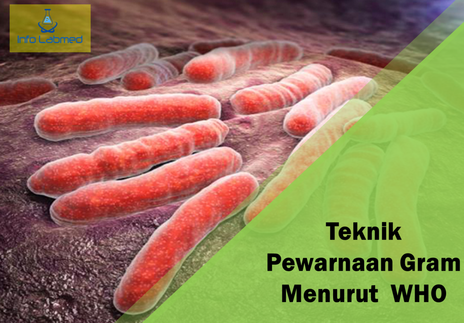Teknik Pewarnaan Gram | WHO