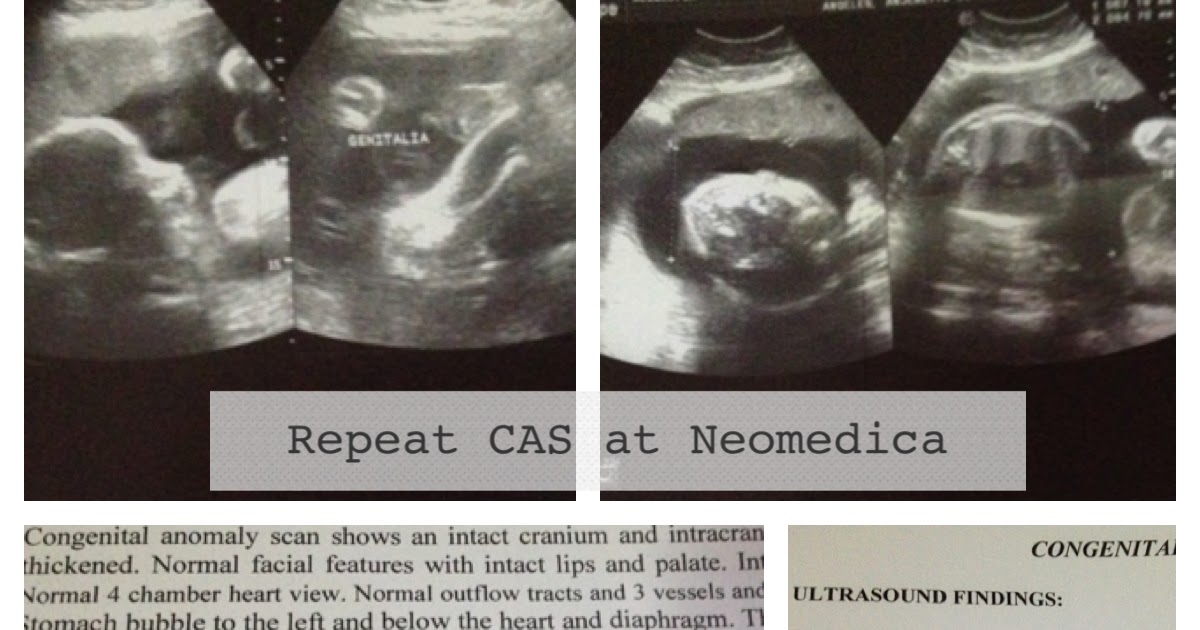 OUR INFERTILITY BATTLE: CAS (repeat) vs Pelvic Ultrasound