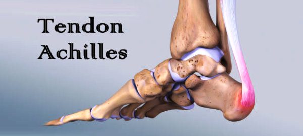 Cedera Tendon Achilles: Gejala, Perawatan, dan Pencegahan | Medkes