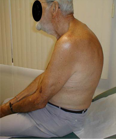 DescubreSemiologiaQuirurgicautesa: Torax Y Abdomen