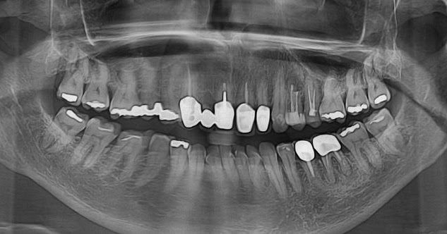 Why we need a Digital OPG Dental X-Ray Center? - Helvetia Diagnostics ...