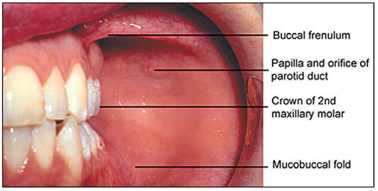 Case Report : Cosmetic-Esthetic Dentistry with Frenectomy and Veneer